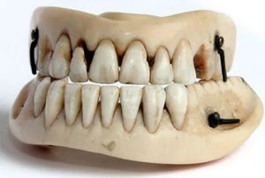 Lisa del Giocondo's Teeth | Warehouse 13 Artifact Database Wiki | Fandom