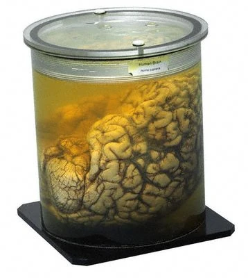 Artifacts/Warehouse 14/Abby Normal's Brain | Warehouse 14 Roleplay Wiki ...