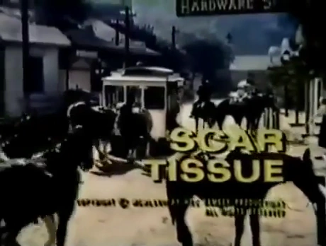 Scar Tissue | Western Series Wiki | Fandom