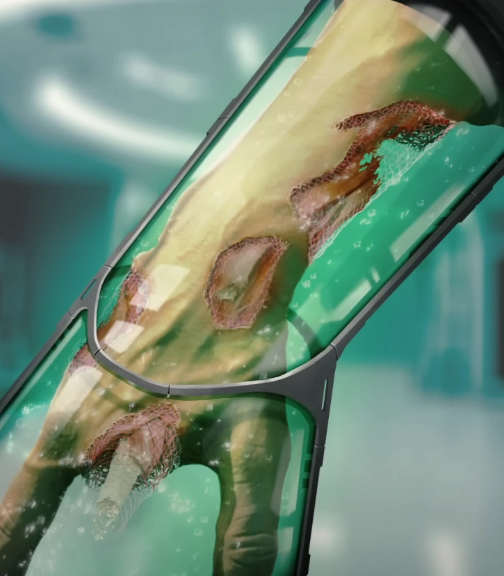 Tissue Regeneration | Xenonauts Wiki | Fandom