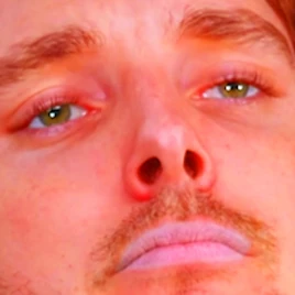 LazarBeam | Wikitubia | Fandom