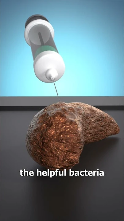 How A Poop Transplant Works 💩🤔 | Zack D. Films Wiki | Fandom