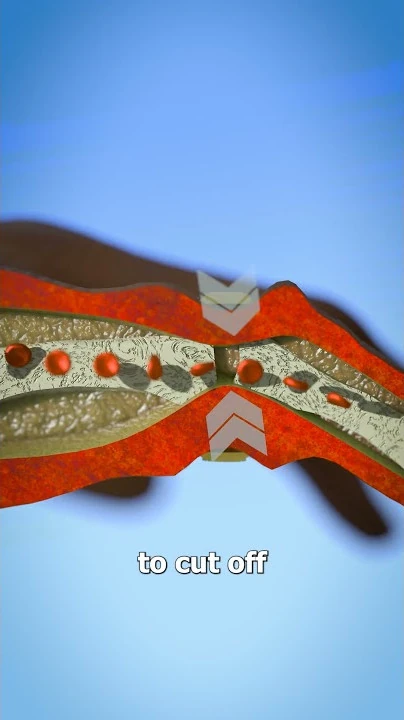 How A Ring Becomes Entrapped 💍🖐️ | Zack D. Films Wiki | Fandom