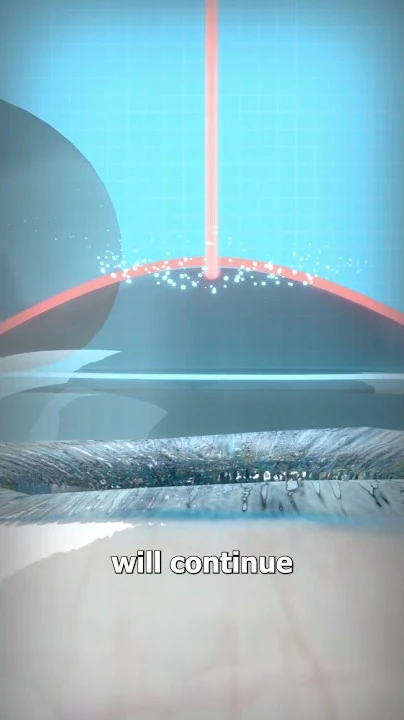 How Lasik Surgery Works 👀 | Zack D. Films Wiki | Fandom