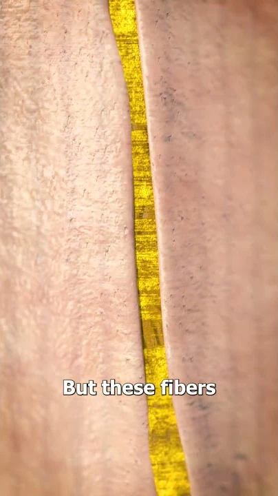 How Scars Form 🤕 | Zack D. Films Wiki | Fandom