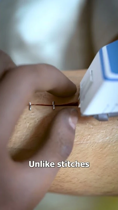 How Medical Staples Work 🤔 | Zack D. Films Wiki | Fandom