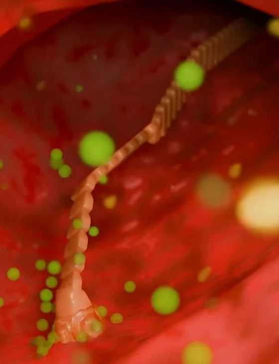 Tapeworm | Zack D. Films Wiki | Fandom